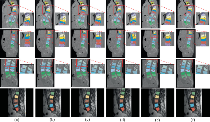 Frequency-Enhanced Multi-granularity Context Network for Efficient ...