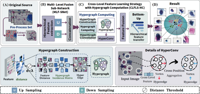 High-Precision Mixed Feature Fusion Network Using Hypergraph Computation for Cervical Abnormal ...