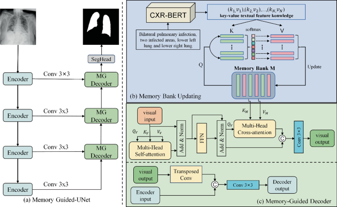 MG-UNet: A Memory-Guided UNet for Lesion Segmentation in Chest Images ...