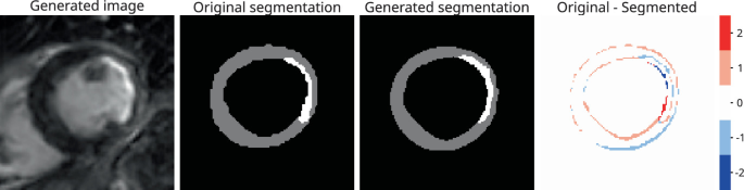 Controllable Latent Diffusion Model to Evaluate the Performance of Cardiac Segmentation Methods ...