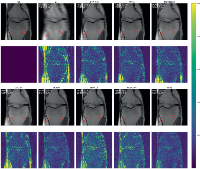 MDPG: Multi-domain Diffusion Prior Guidance for MRI Reconstruction ...