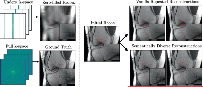Mind the Detail: Uncovering Clinically Relevant Image Details in ...