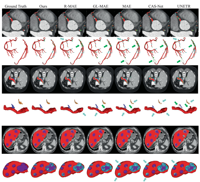 Non-salient Object Segmentation in Medical Images via Pre-trained Multi ...