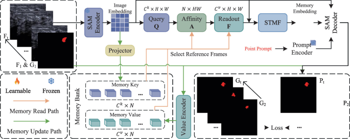 Spatial-Temporal Memory Filtering SAM for Lesion Segmentation in Breast ...