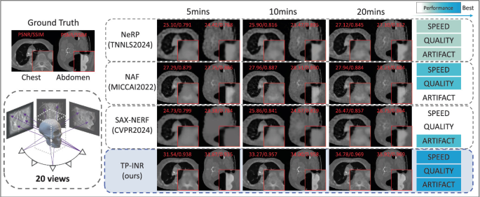 Target Prior-Enriched Implicit 3D CT Reconstruction with Adaptive Ray ...
