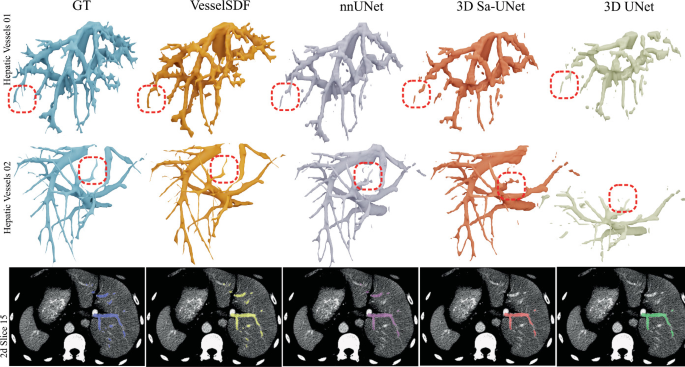 VesselSDF: Distance Field Priors for Vascular Network Reconstruction ...