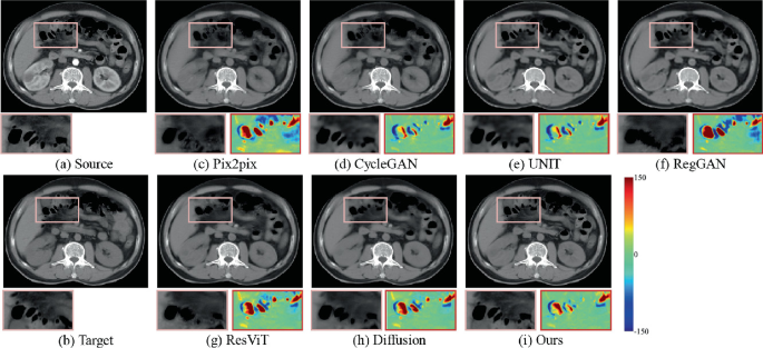 Boosting Medical Image Synthesis via Registration-Guided Consistency ...