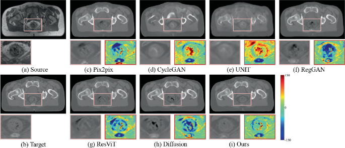 Boosting Medical Image Synthesis via Registration-Guided Consistency ...