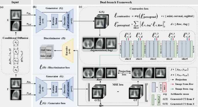 DCT-Net: Dual-Branch CT Reconstruction from Orthogonal X-Rays with Diffusion Model and ...