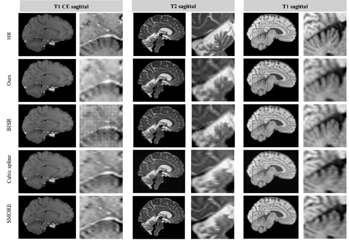 Faster, Self-supervised Super-Resolution for Anisotropic Multi-view MRI ...