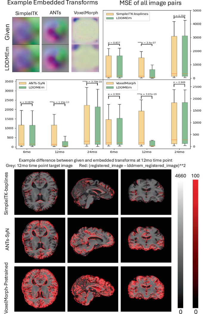 LDDMEm: Large Deformation Diffeomorphic Metric Embedding | SpringerLink