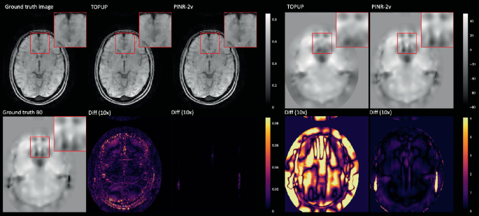 Physics-Informed Implicit Neural Representations for Joint B0 ...