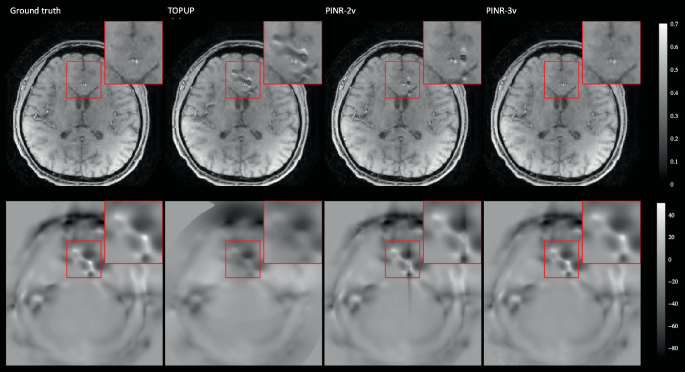 Physics-Informed Implicit Neural Representations for Joint B0 ...