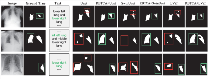 Region-Based Text-Consistent Augmentation for Multimodal Medical Segmentation | SpringerLink