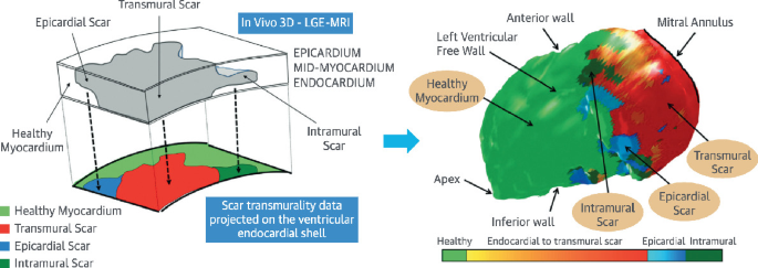 Automated Characterization of Myocardial Scar Topological Patterns for ...