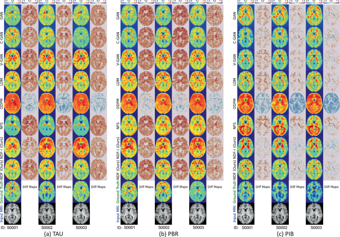 Distribution-Guided Multi-tracer Brain PET Synthesis from Structural ...