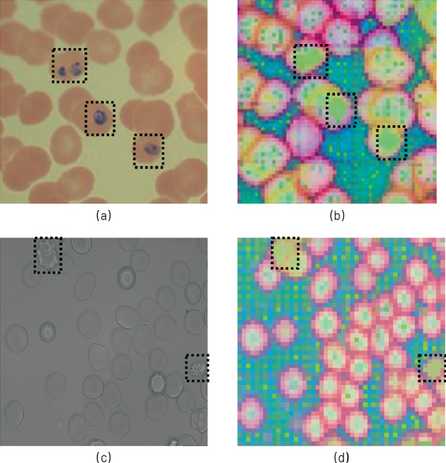 RedDino: A Foundation Model for Red Blood Cell Analysis | Springer ...