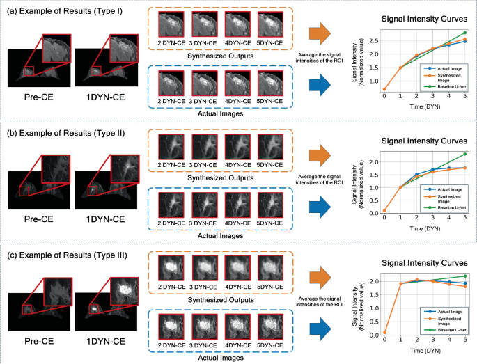Synthesizing Delayed-Phase Contrast-Enhanced Breast MR Images from ...
