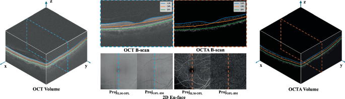 XOCT: Enhancing OCT to OCTA Translation via Cross-Dimensional ...