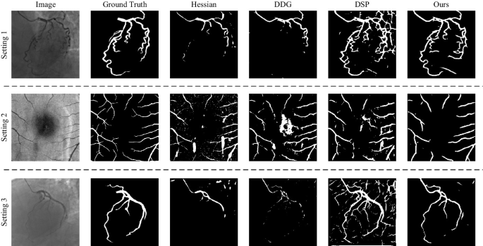 A Multi-Branch Framework for Cross-Domain Vessel Segmentation via the ...