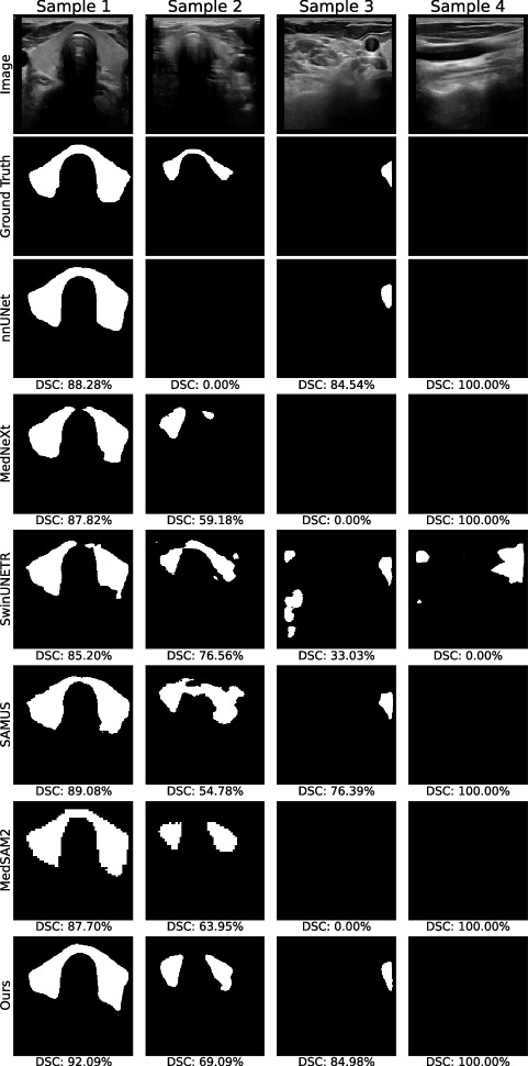 Adapting Vision Foundation Models for Real-Time Ultrasound Image ...