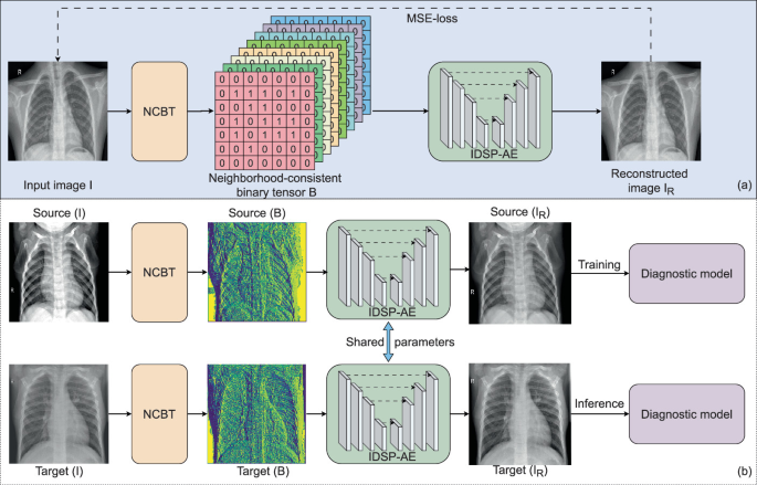 Neighborhood-Consistent Binary Transformation for Domain-Invariant Chest X-Ray Diagnosis ...