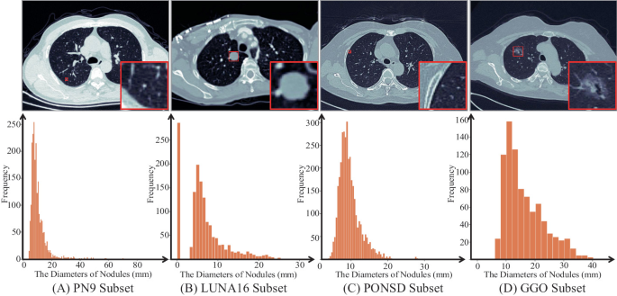 Domain Generalization for Pulmonary Nodule Detection via ...