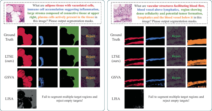 LTSE: Language-Guided Tissue Referring Segmentation in Pathology Images ...