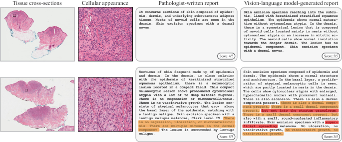 Pathology Report Generation and Multimodal Representation Learning for ...