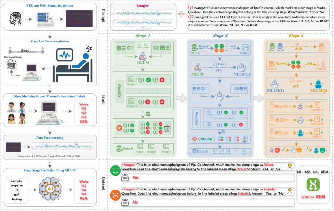 Robust Sleep Stage Prediction from Electroencephalogram with Label Noise Using Multimodal Large ...