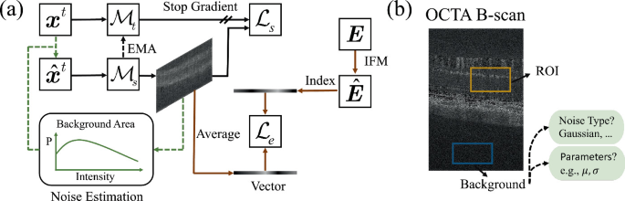 Improving OCTA Imaging Through Cross-Domain Adaptation: A Noise-Guided Framework Using ...