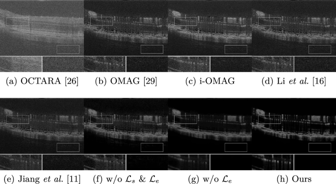 Improving OCTA Imaging Through Cross-Domain Adaptation: A Noise-Guided Framework Using ...