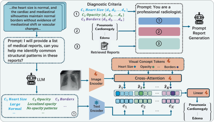 RadAlign: Advancing Radiology Report Generation with Vision-Language ...