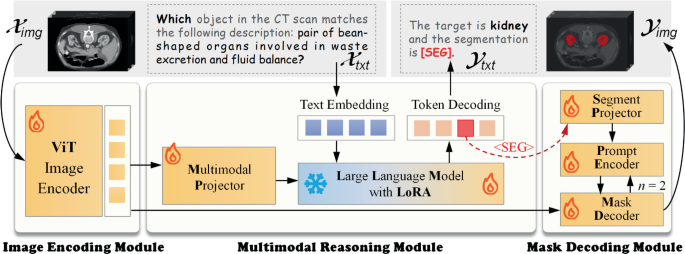 R1Seg-3D: Rethinking Reasoning Segmentation for Medical 3D CTs ...