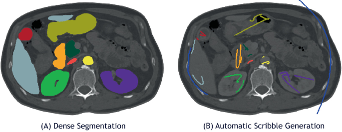 Revisiting 3D Medical Scribble Supervision: Benchmarking Beyond Cardiac ...