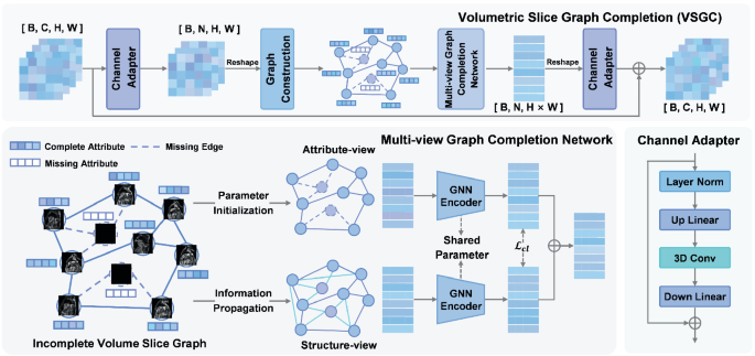 SAGCNet: Spatial-Aware Graph Completion Network for Missing Slice ...