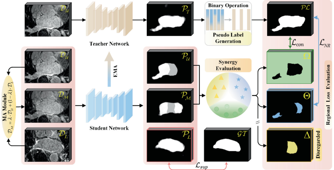 Synergy-Guided Regional Supervision of Pseudo Labels for Semi-supervised Medical Image ...