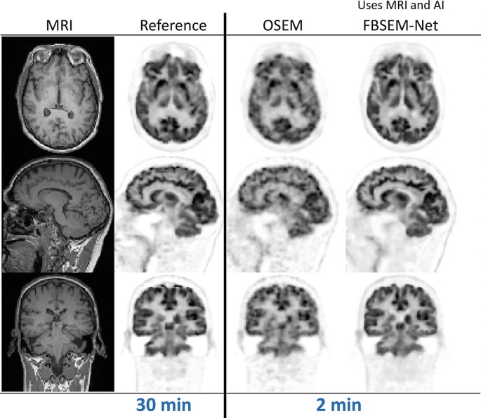 AI Applications in Nuclear Medicine and Hybrid Imaging | Springer ...