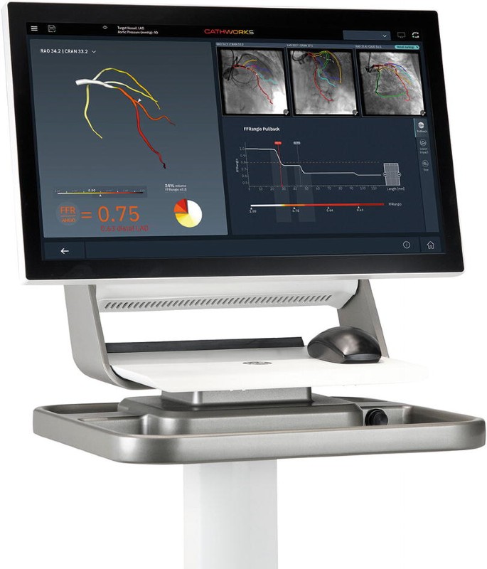 AI in Interventional Radiology and Cardiology | Springer Nature Link ...