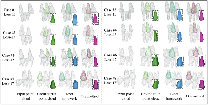3D Dynamic Prediction of Missing Teeth in Diverse Patterns via Centroid ...