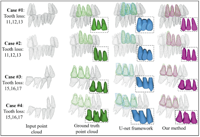 3D Dynamic Prediction of Missing Teeth in Diverse Patterns via Centroid ...