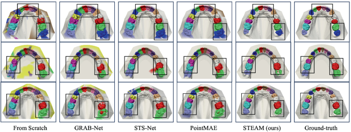 STEAM: Self-supervised TEeth Analysis and Modeling for Point Cloud Segmentation | SpringerLink