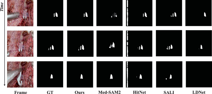 HRVVS: A High-Resolution Video Vasculature Segmentation Network via ...