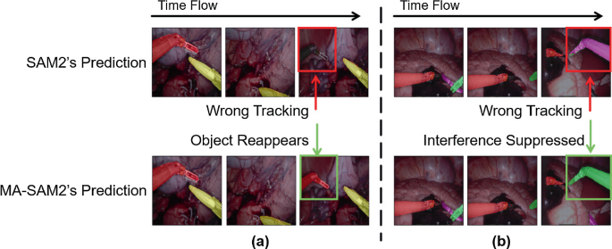 Memory-Augmented SAM2 for Training-Free Surgical Video Segmentation | SpringerLink