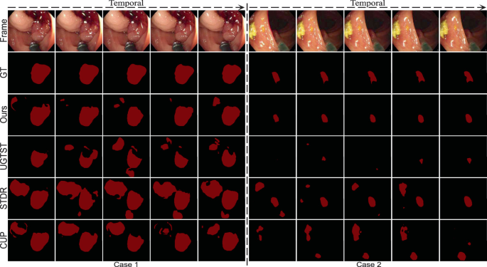 Source-Free Active Domain Adaptation for Efficient Medical Video Polyp Segmentation | SpringerLink