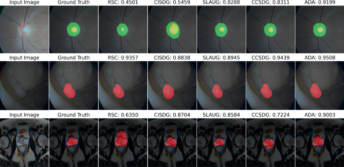 ADA: An Adaptive Augmentation Framework for Single-Source Domain ...