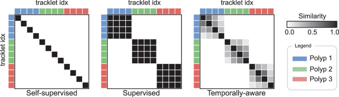 Temporally-Aware Supervised Contrastive Learning for Polyp Counting in ...