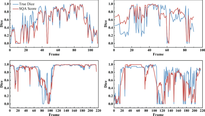 Unsupervised Quality Control and Enhancement of Polyp Segmentation in Colonoscopy Videos Using ...