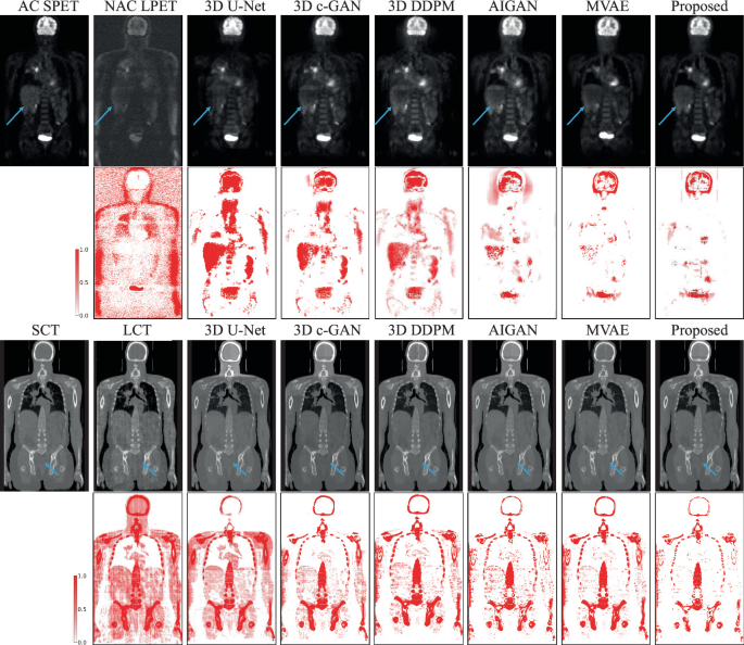 A New Paradigm for Low-Dose PET/CT Reconstruction with Mamba-Powered ...