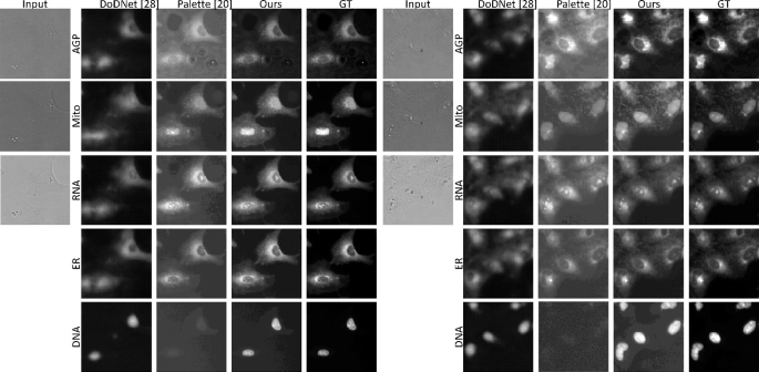 DiffStain: Conditioned Diffusion-Based Semantic Virtual Staining with ...